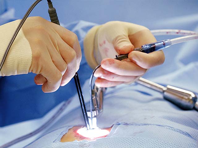 Procedure – Atlantis